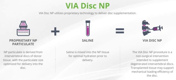 Via Disc NP: A New Non-Surgical Treatment for Lumbar Degenerative Disc ...