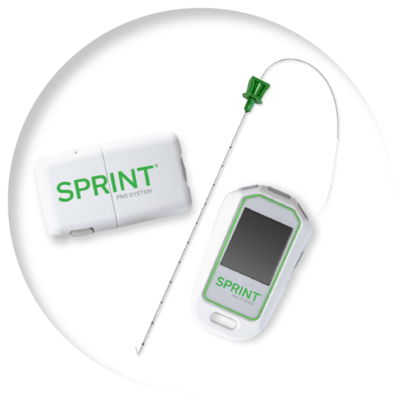 Peripheral Nerve Stimulator Trial and Implant - San Diego, CA